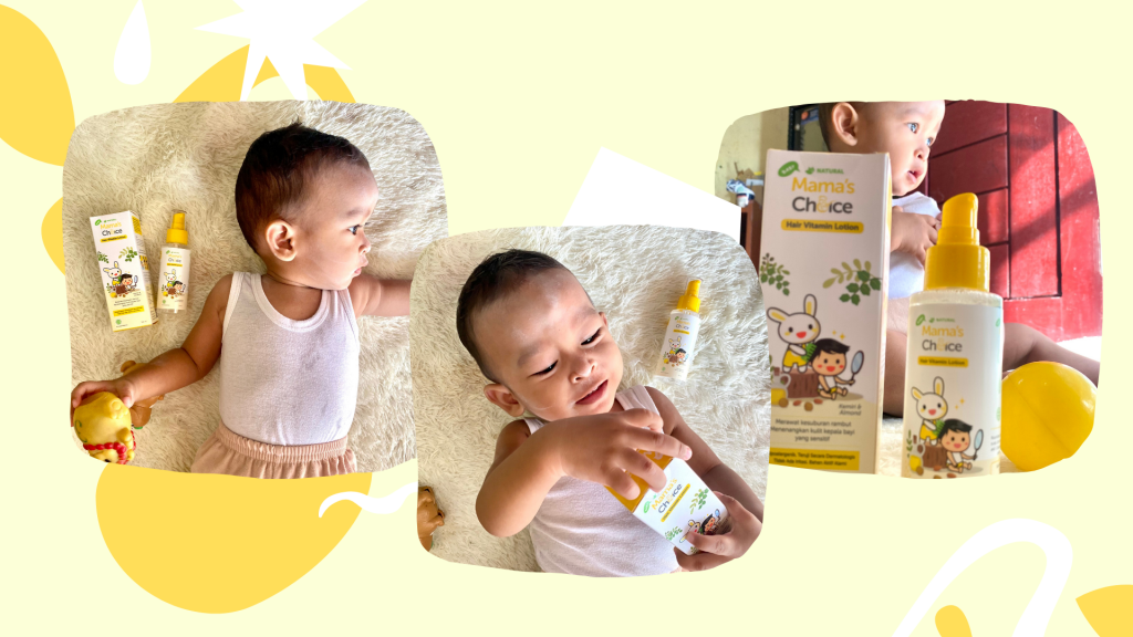 Tips Anti Ribet Merawat Kulit Kepala dan Rambut Bayi Laki-Laki Agar ...